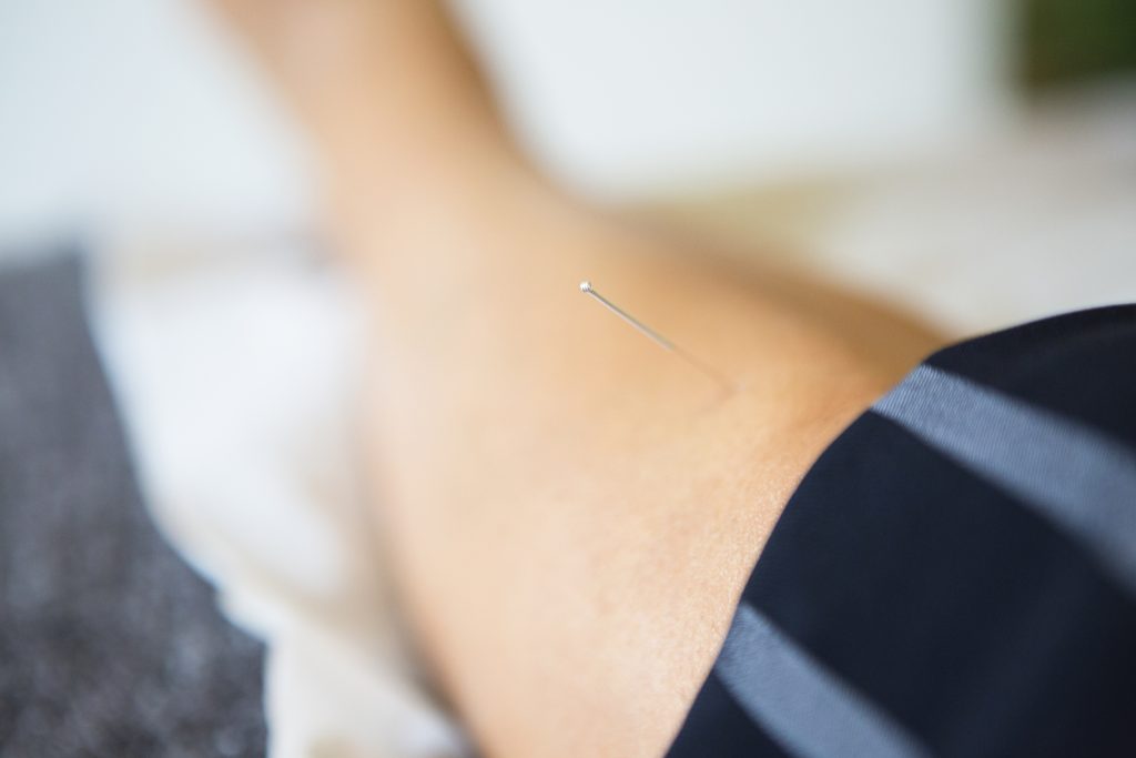 bma | Information about Acupuncture, Moxibustion and Cupping